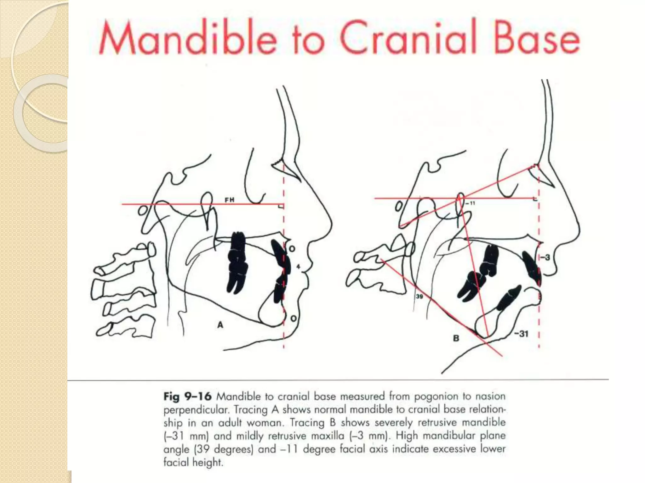 Ricketts analysis | PPTX