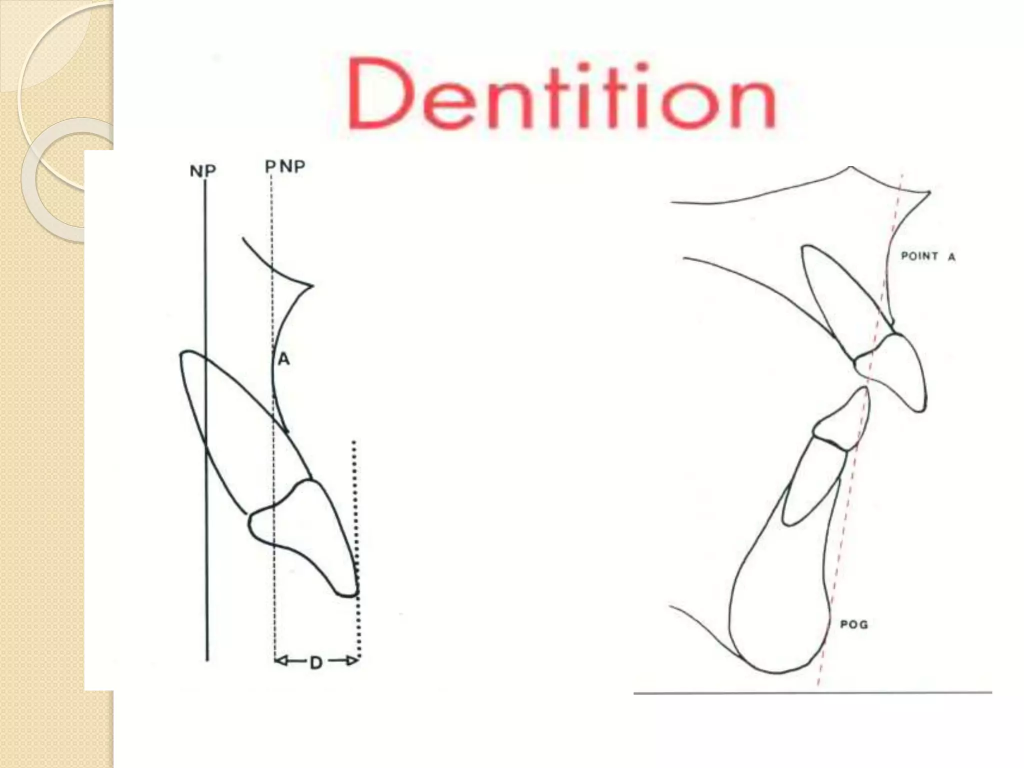 Ricketts analysis | PPTX