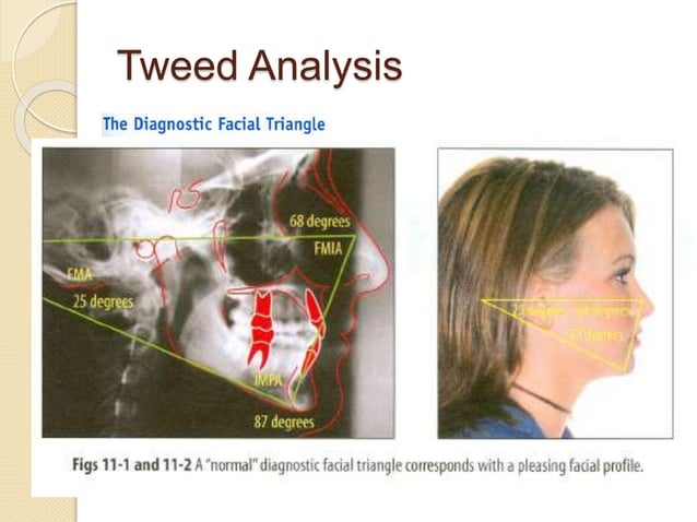 Ricketts analysis | PPTX