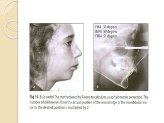 Ricketts analysis | PPTX