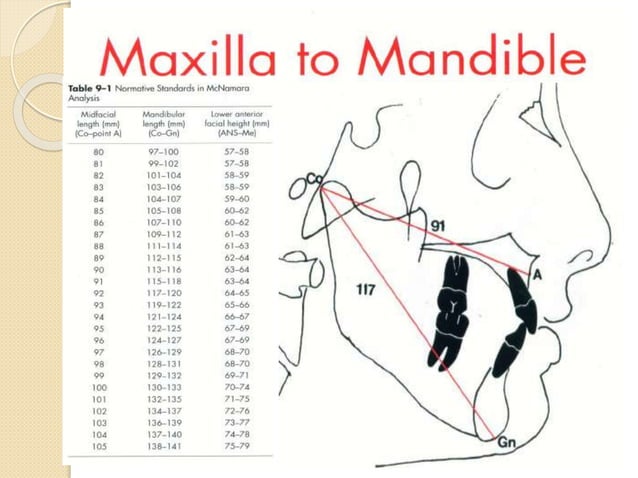 Ricketts analysis | PPTX