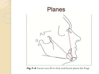 Ricketts analysis | PPTX