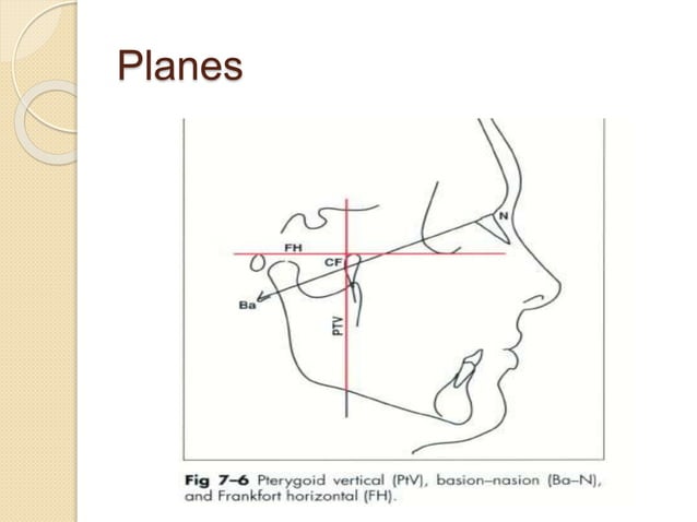 Ricketts analysis | PPTX