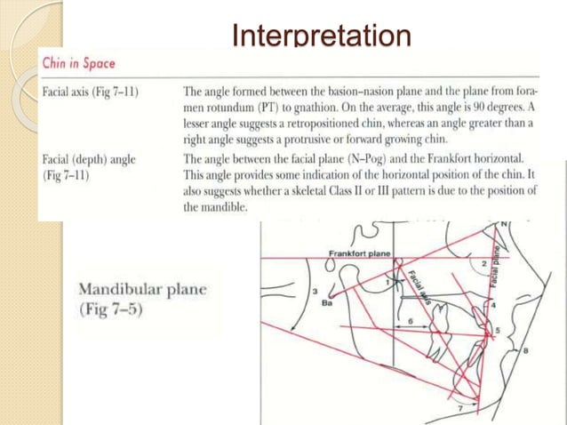 Ricketts analysis | PPTX