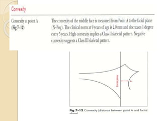 Ricketts analysis | PPTX
