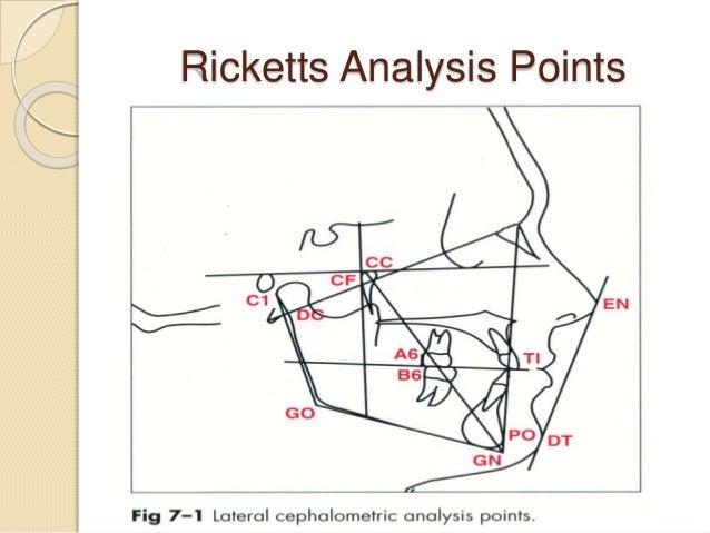 Ricketts analysis