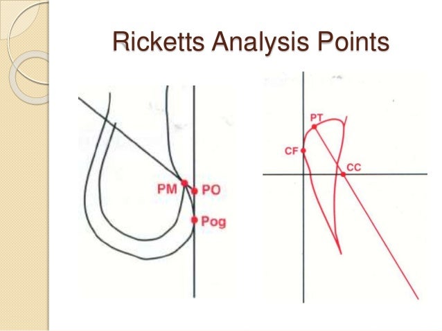 Ricketts analysis