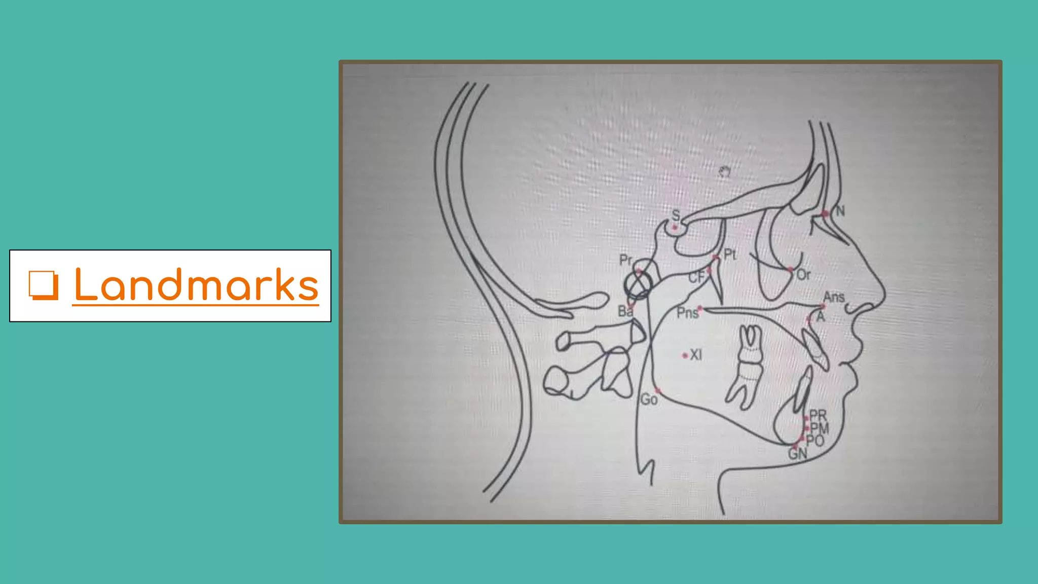 Ricketts analysis | PPTX