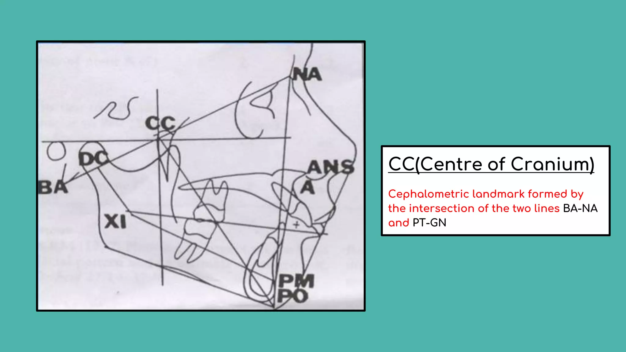 Ricketts analysis | PPTX