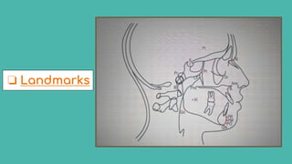 Ricketts analysis | PPTX