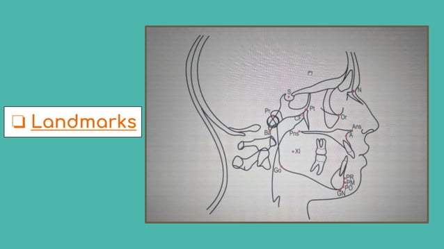 Ricketts analysis | PPTX | Dental Health | Diseases and Conditions