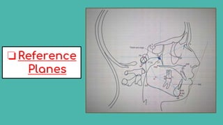 Ricketts analysis | PPTX
