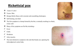 Rickettsia | PPTX