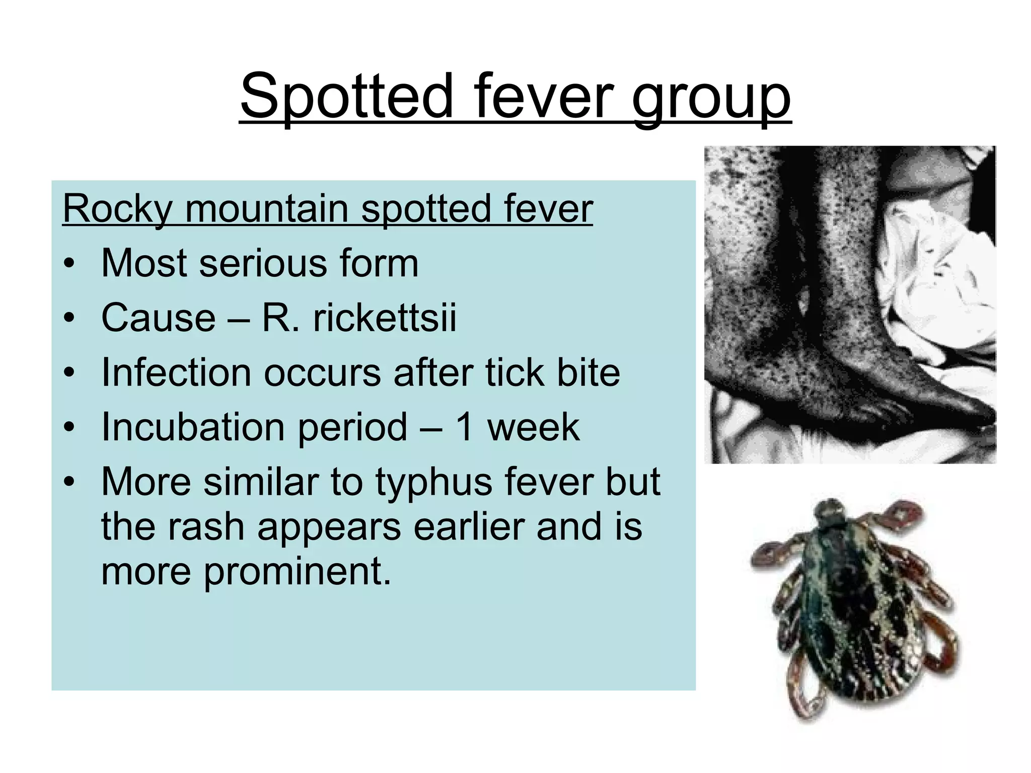 Rickettsia | PPT