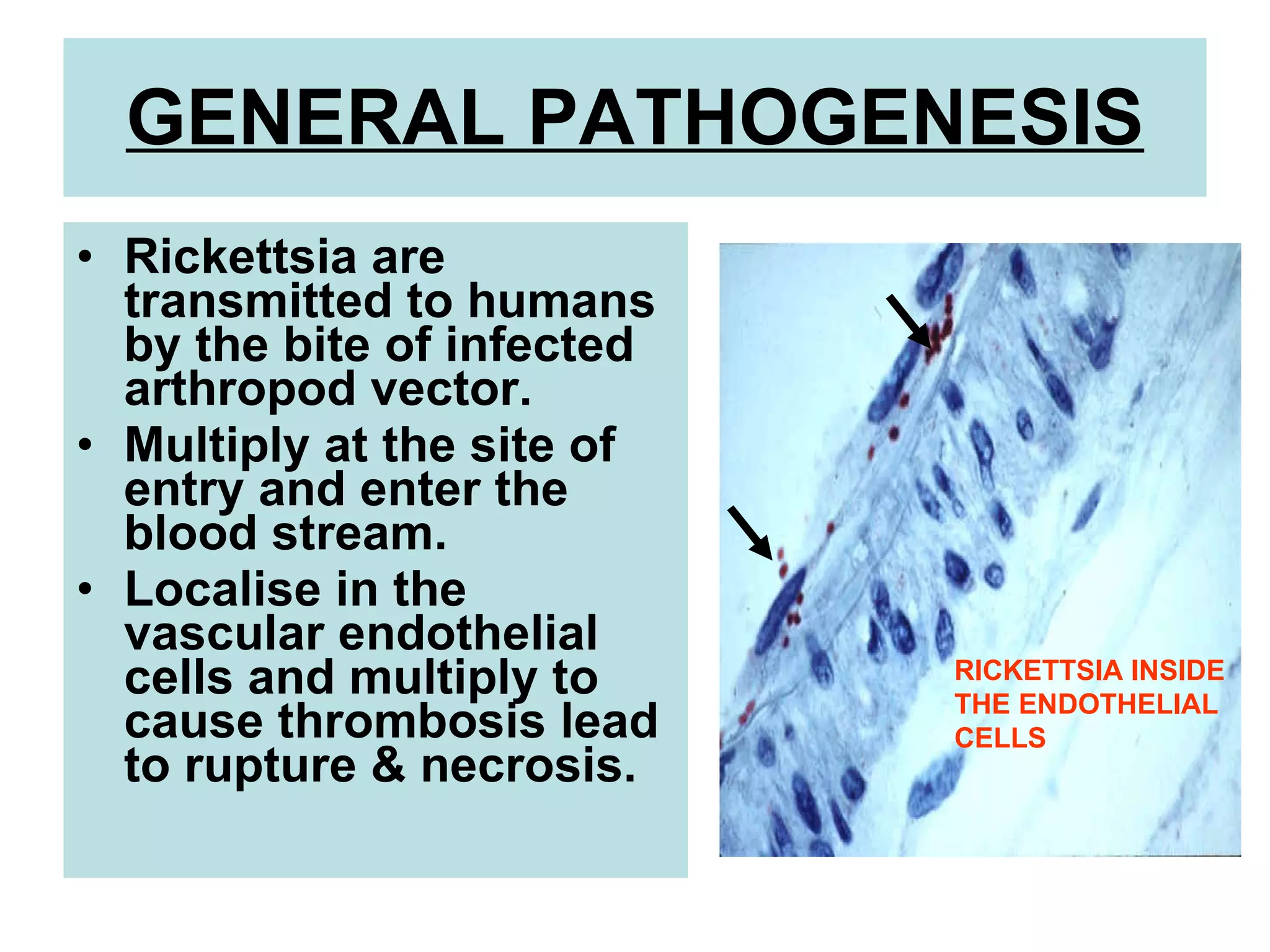 Rickettsia | PPT