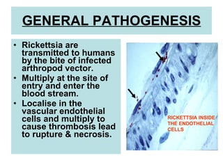 Rickettsia | PPT