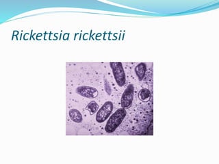 Rickettsia Rickettsii Microscope