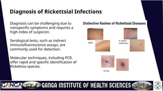Rickettsia - life cycle and diagnostic methods.pptx | Infectious ...