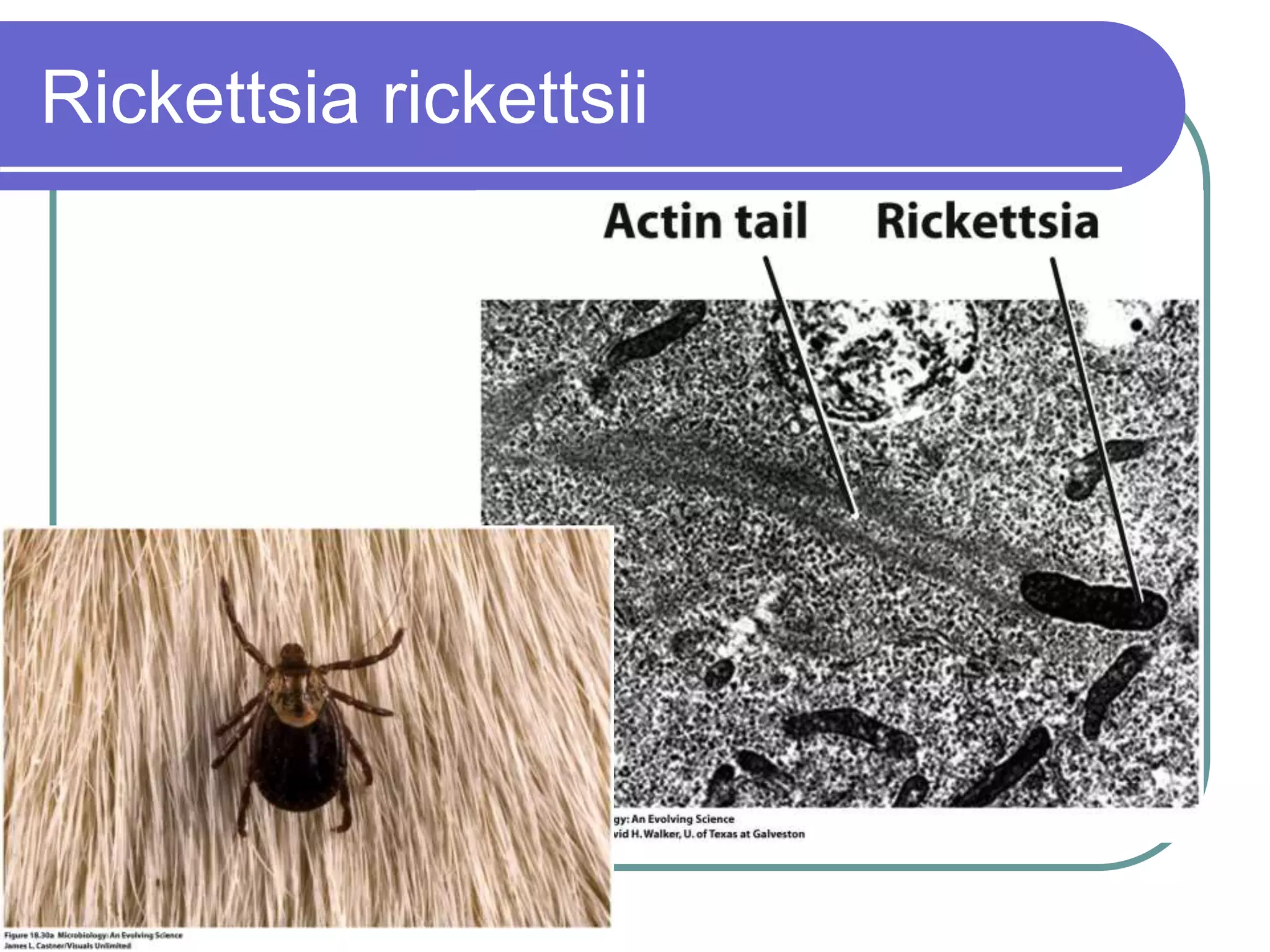 Rickettsia-Chlamydia-Mycoplasma-Legionella-and-Gardnerella.ppt