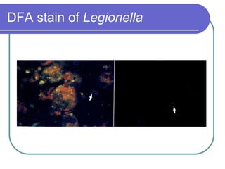 Rickettsia-Chlamydia-Mycoplasma-Legionella-and-Gardnerella.ppt