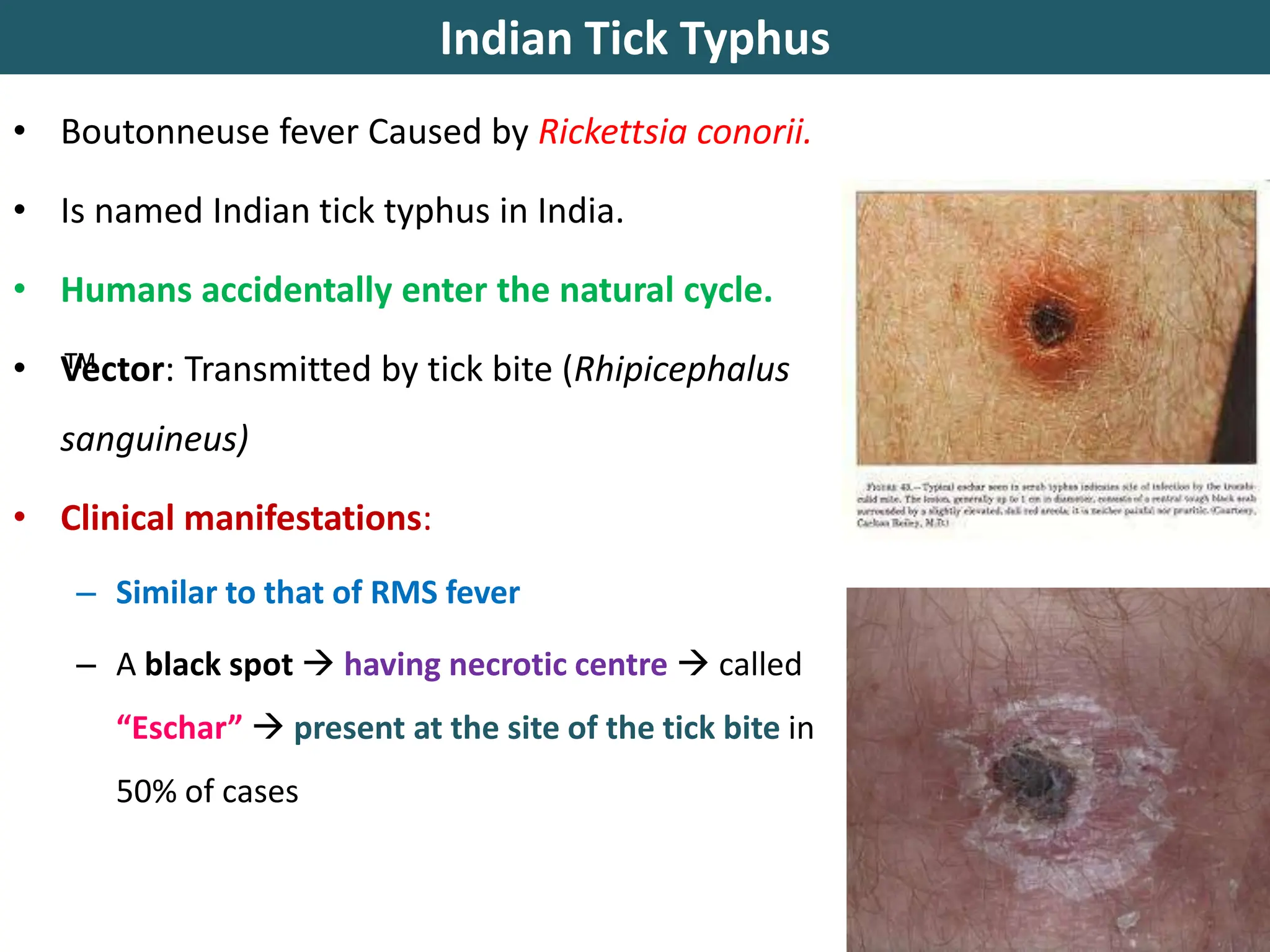 Rickettsia by Dr. Rakesh Prasad Sah.pptx