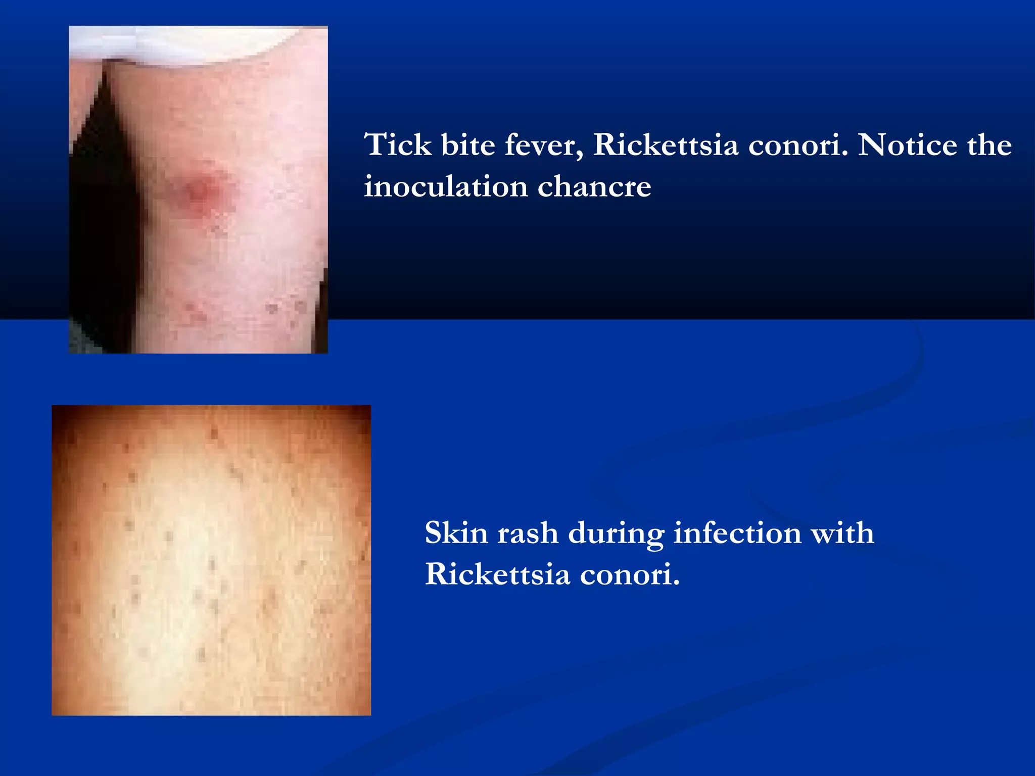 Rickettsiaceae 1 | PPT