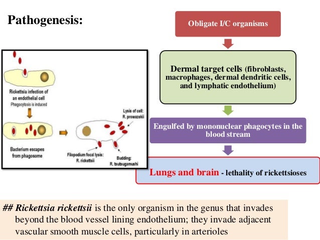 Rickettsial Diseases
