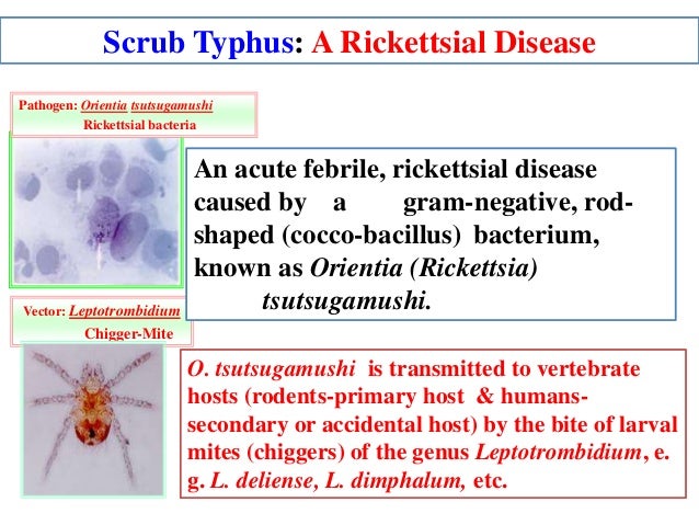 Rickettsial Diseases