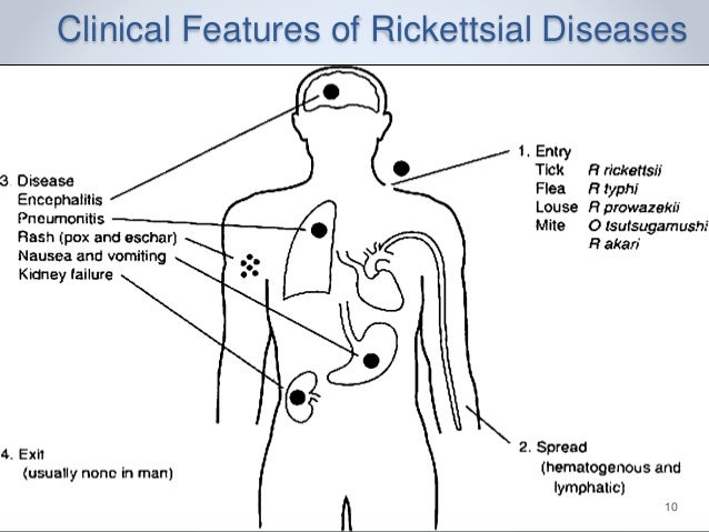 Rickettsial diseases seminar 2016