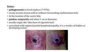 Rickettsial Infection.pptx