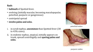 Rickettsial Infection.pptx