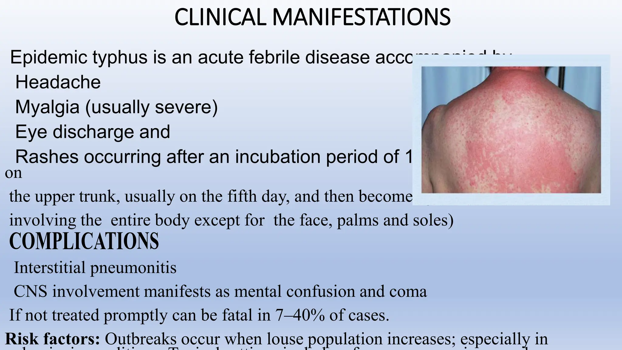 RICKETTSIAL INFECTION.pptx