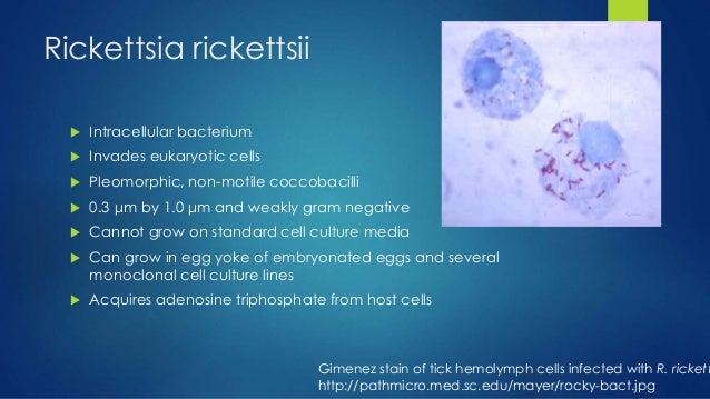 Rickettsia rickettsii presentation