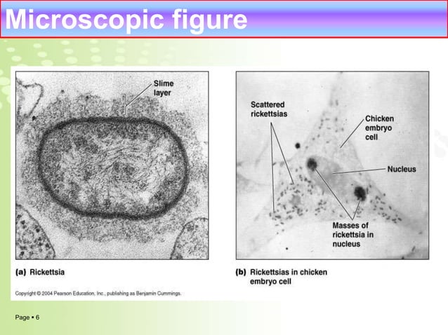 Rickettsia | PPT | Infectious Diseases | Diseases and Conditions