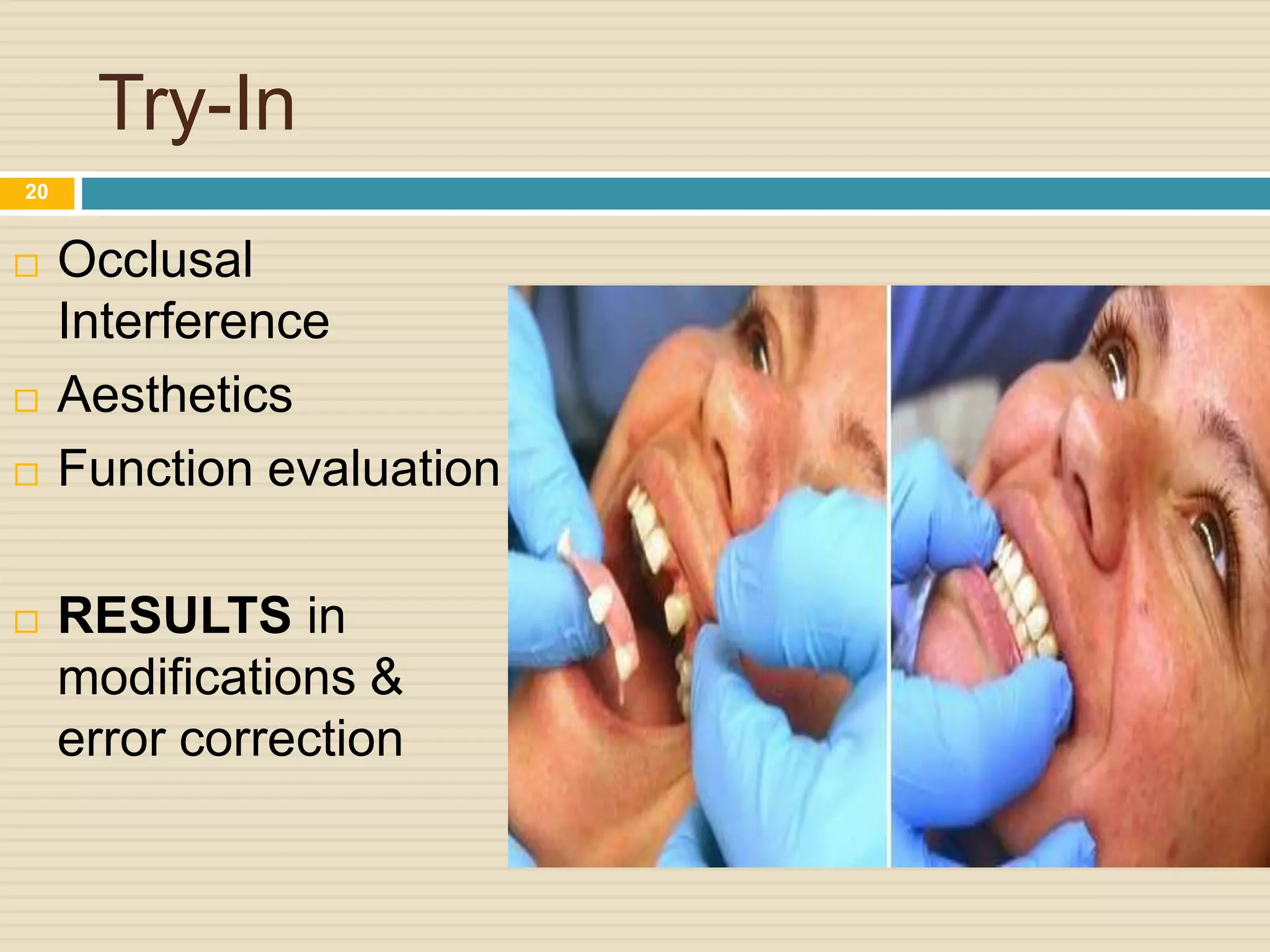 Steps Of Fabrication Of Removable Partial Denture Pptx