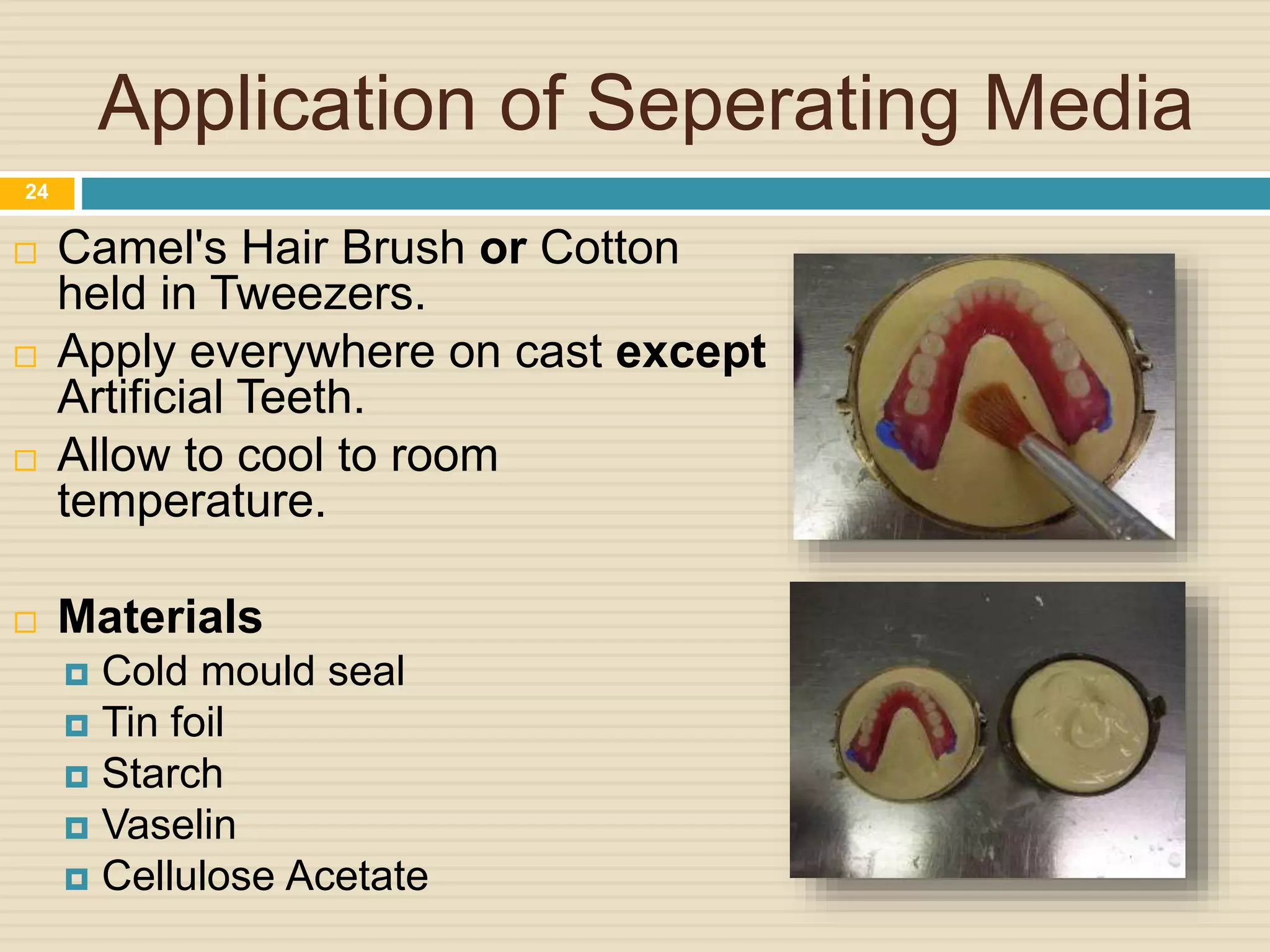 Steps Of Fabrication Of Removable Partial Denture Pptx