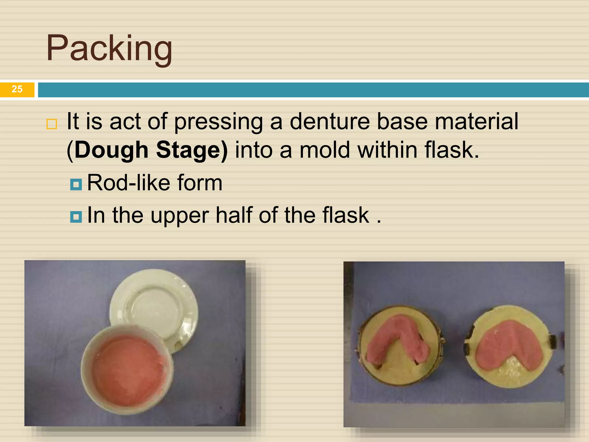 Steps Of Fabrication Of Removable Partial Denture Pptx