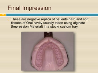 Steps of Fabrication of Removable Partial Denture | PPTX