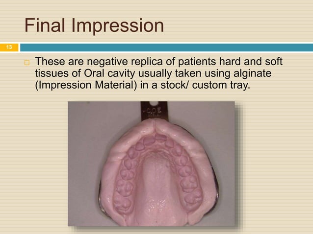 Steps of Fabrication of Removable Partial Denture | PPTX | Oral care ...