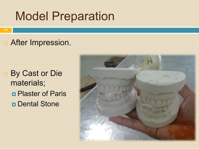 Steps of Fabrication of Removable Partial Denture | PPTX | Oral care ...