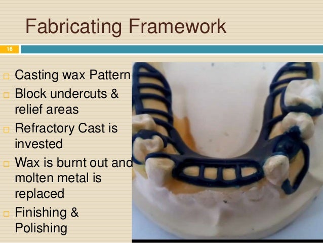 Steps of Fabrication of Removable Partial Denture