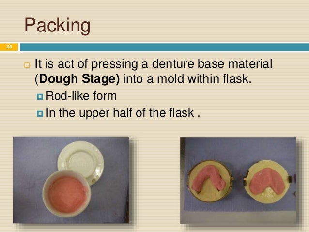 Steps of Fabrication of Removable Partial Denture