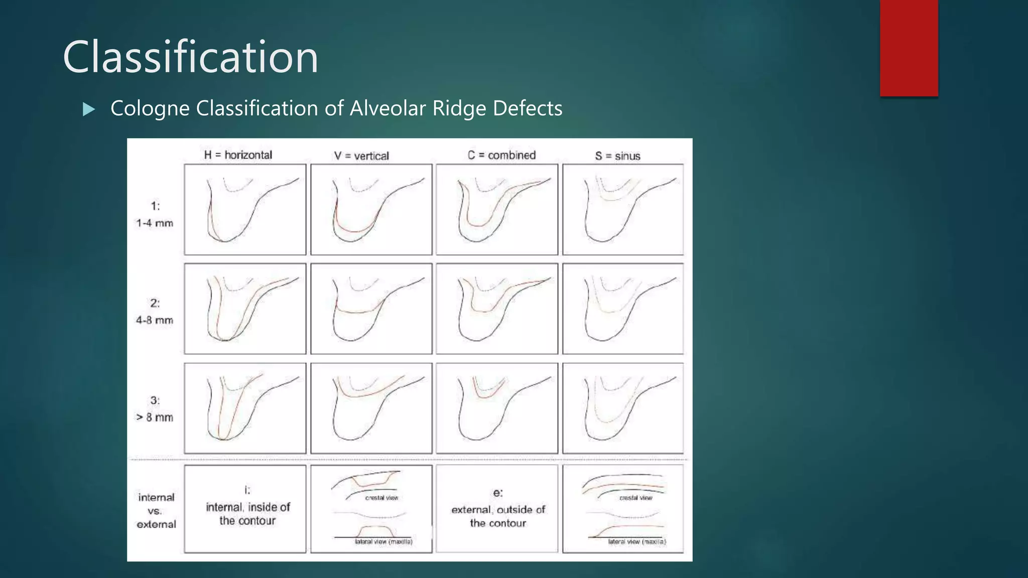 Ridge augmentation - Dr. Kinjal ghelani | PPTX