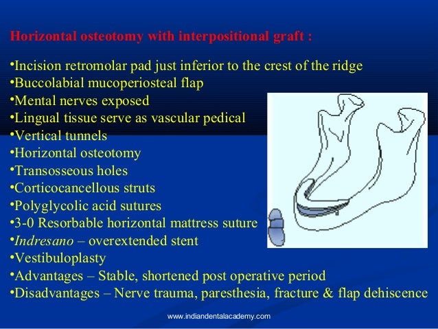 Ridge augmentation procedures /orthodontic courses by Indian dental