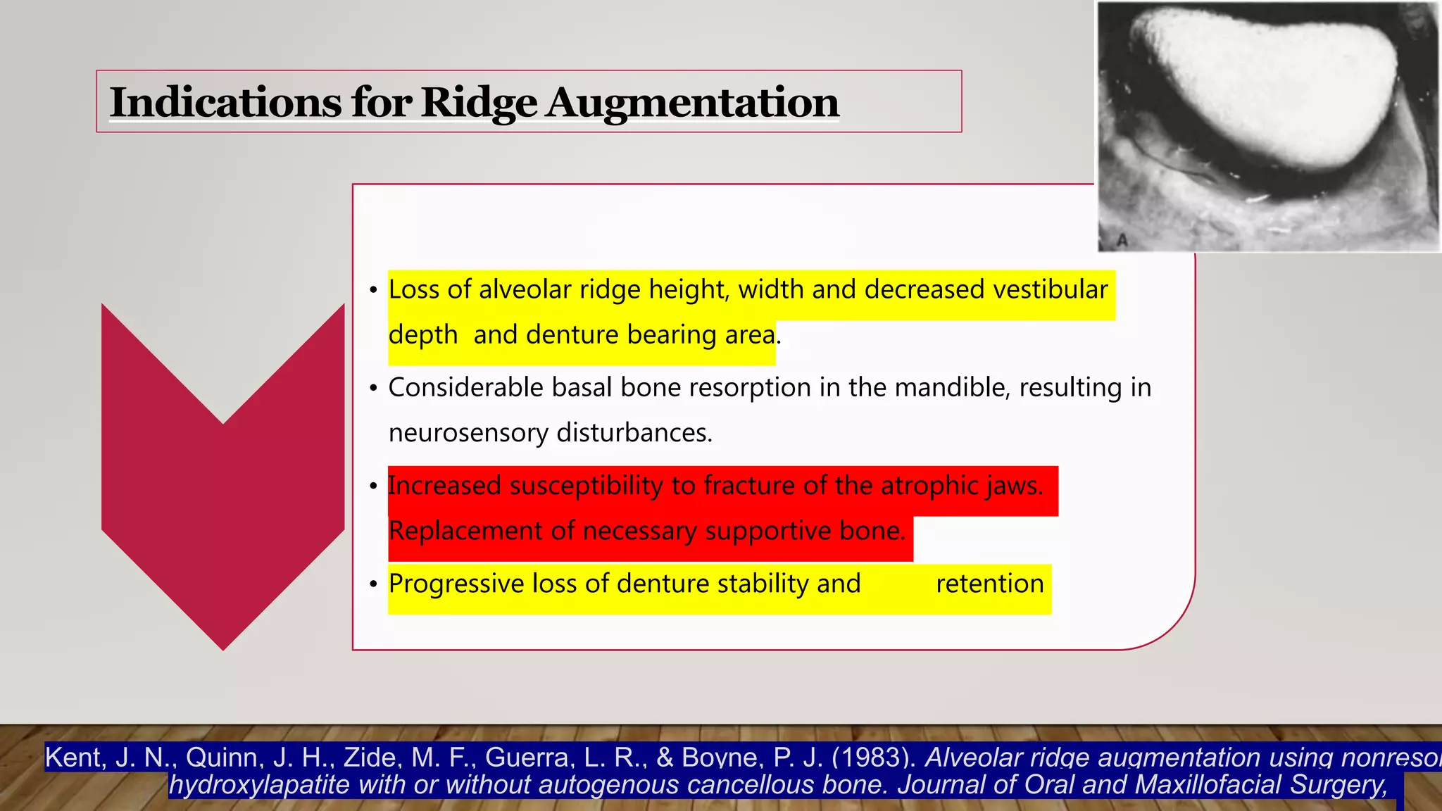 Ridge augmentation seminar | PPTX