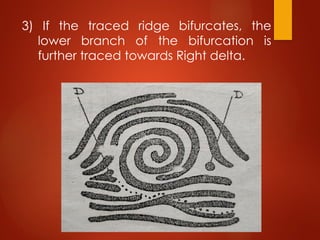 ridge counting amd ridge tracing is ridges crossing or touching an ...