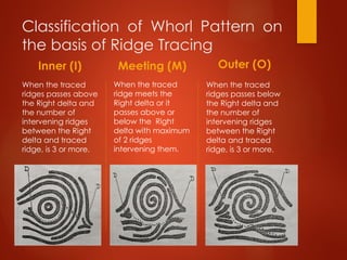 ridge counting amd ridge tracing is ridges crossing or touching an ...