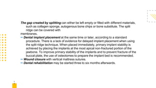 Ridge split in implantology | PPTX