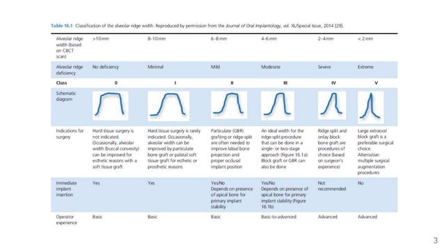 Ridge split in implantology | PPTX | Bone and Joint Conditions ...
