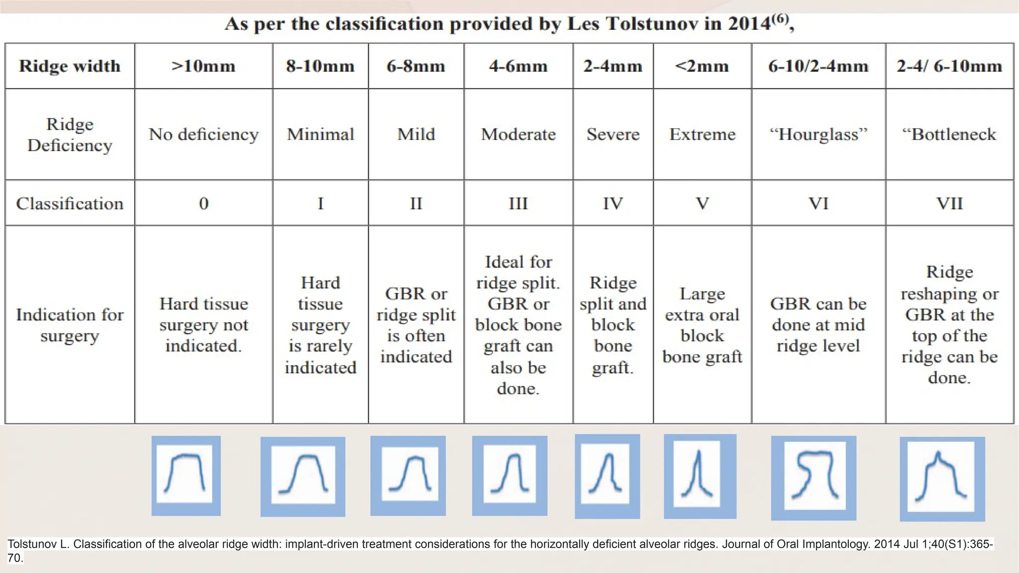 Ridge Split Techniques in Prosthodontics: Enhancing Alveolar Ridge for ...
